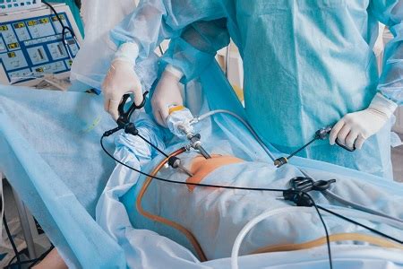 All About Laparoscopic Surgery Minimally Invasive Techniques