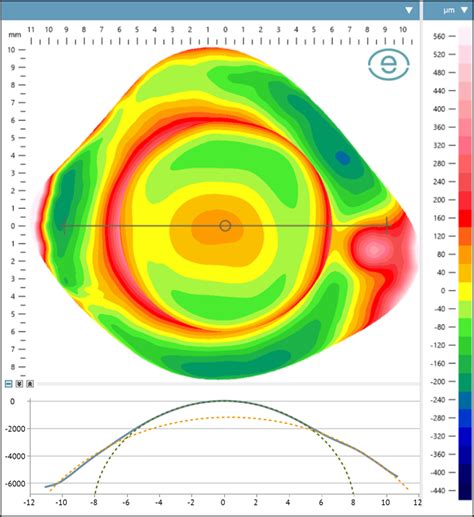 Profilometry Maps Eaglet Eye
