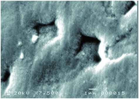The Depressions Appear Wedge Shaped Crystals Are Formed As Small