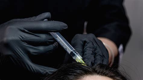 Scalp PRP Beauty Lounge Med Spa