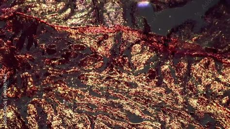 Contrast Microscopic Slide With Cervix Tissue Sample Magnified In 100