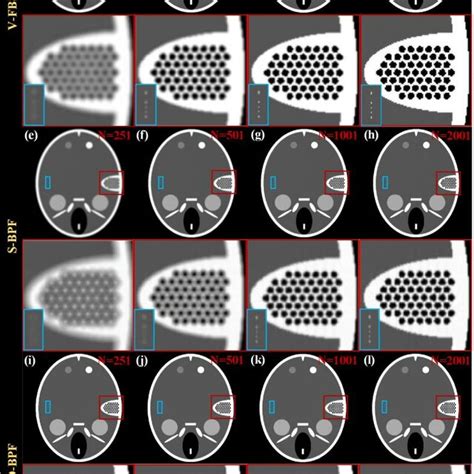 Reconstruction Results Via V Fbp S Bpf And D Bpf A D Results Of