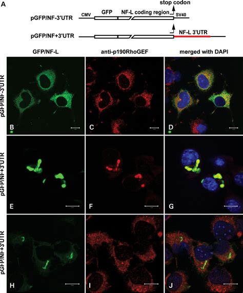 Figure 1 From Rna Binding Protein Is Involved In Aggregation Of Light