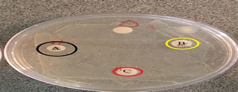 Effect Of Erythromycin A Ampicillin B And Gentamicin C On Lb