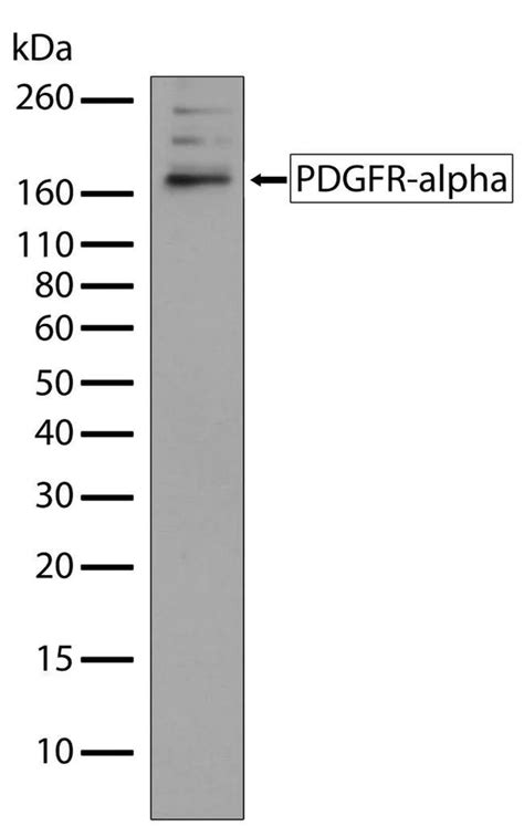 Anti Pdgfr Alpha Antibody Rp23040031 Ab313400 Abcam