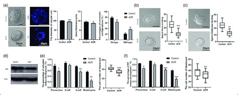 Effects Of Acr On The Diameter Chromatin Configuration Sperm Binding