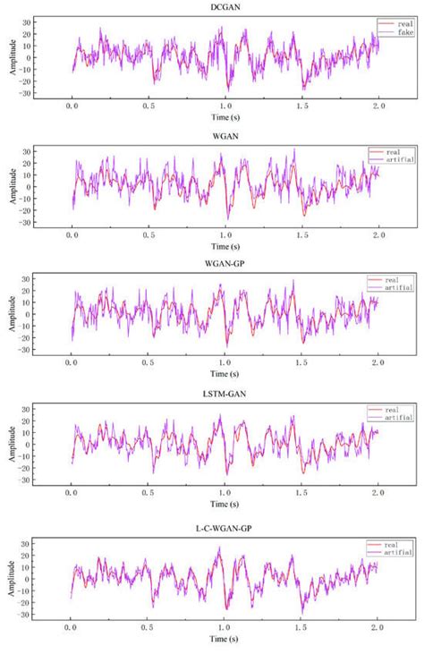 Electroencephalographic Signal Data Augmentation Based On Improved Generative Adversarial Network