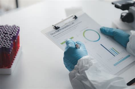 실험실은 병원에서 환자를 샘플링하여 얻은 혈액을 검사하고 연구하는 과학 연구에 사용되며 실험실 조수는 이상에 대한 혈액 검사를 수행합니다 실험실 및 전문가 개념 Stem