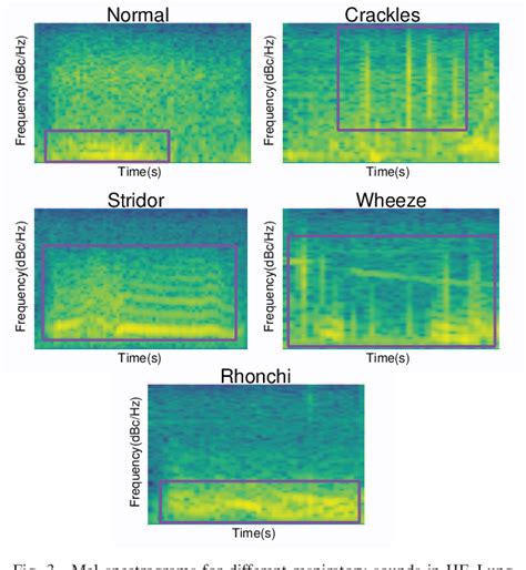Figure 3 From Deep Learning Based Portable Respiratory Sound Classification System Semantic