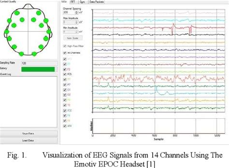 Figure 1 From A Deep Learning Model For Classification Of Eeg Signals