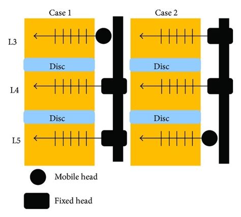 Combination Of Mobile And Fixed Head Pedicle Screw Fixation Download Scientific Diagram