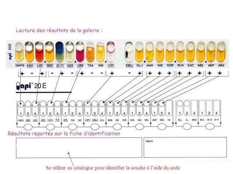 Api 20e Microbiología