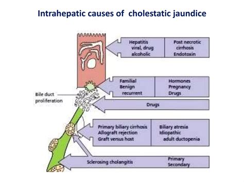 Approach To Cholestatic Jaundice Pptx