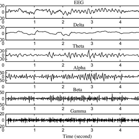 pdf classification of eeg signals for detection of epileptic seizures