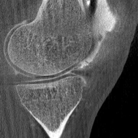 Example Volume And Segmentation A Contrast Enhanced Gray Scale