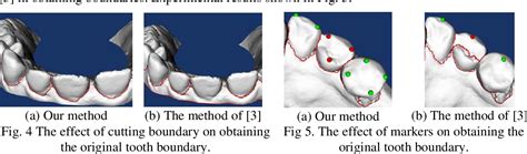 Figure 4 From Interactive Tooth Segmentation Method Of Dental Model Based On Geodesic Semantic