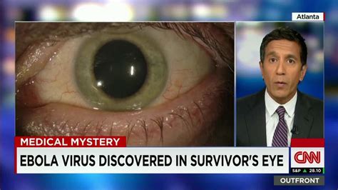 Ebola Found In Eye Months After Recovery Cnn