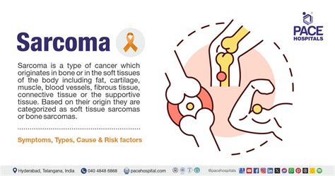 Sarcoma Symptoms Types Causes Treatment And Prevention