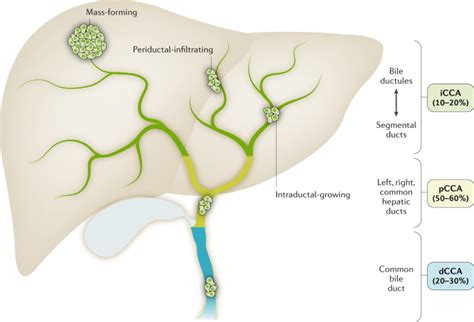 Ppih As A Novel Diagnostic Biomarker In Cholangiocarcinoma