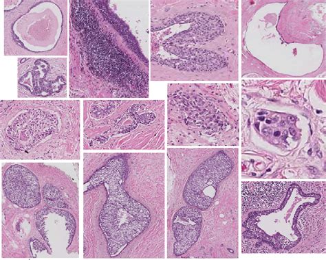 Figure 2 From An End To End Breast Tumour Classification Model Using