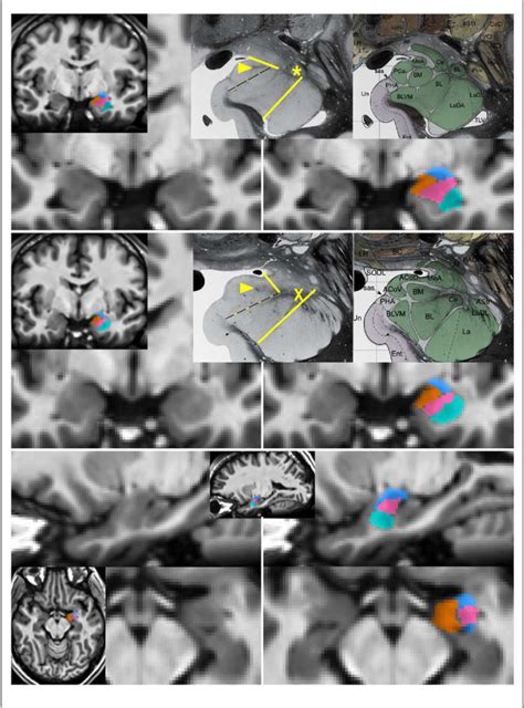 Figure 1 From A 3d Fully Convolutional Neural Network With Top Down