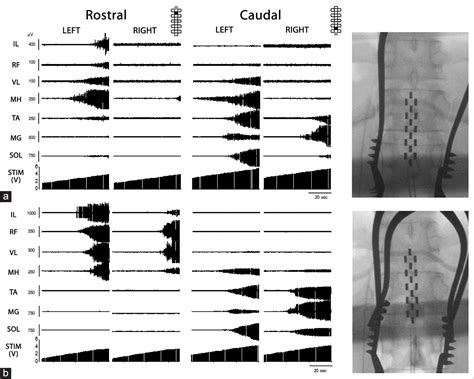 Surgical Neurology International