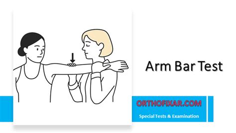 Patellar Tap Test Ballottement Test Orthofixar 2025