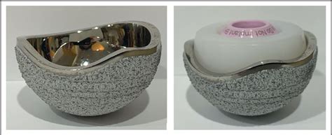 Figure 1 From Use Of A Monoblock Dual Mobility Acetabular Component In Primary Total Hip