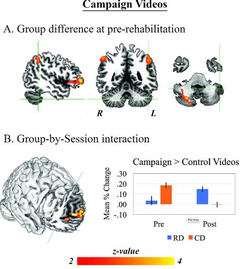 Results Of The GLM Analyses Applied To Data Acquired During Viewing Of Download Scientific