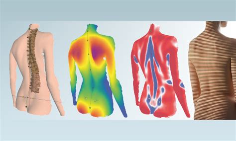 Diers Formetric 4d Pioneer Technology For Spine And Posture Analysis