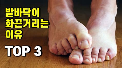 발바닥 뜨거워지는 이유 가지 YouTube