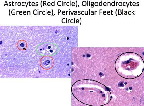 Neuropathology Flashcards Quizlet