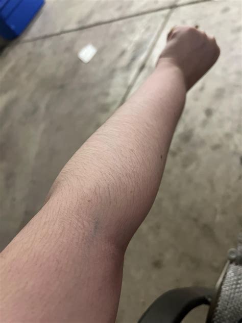 💗[arms]💗 R Girlshairyarms