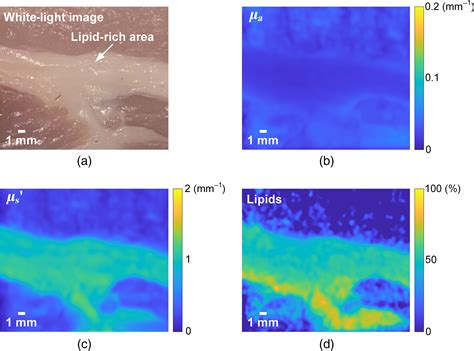 Quantitative Spatial Mapping Of Tissue Water And Lipid Content Using