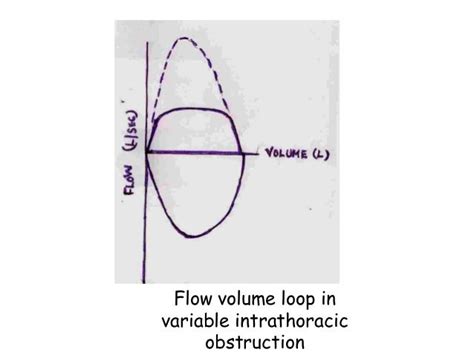 Pulmonary Defense