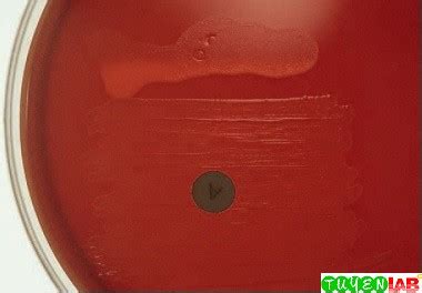 Microbiology Atlas Of Streptococcus Enterococcus And Other Catalase