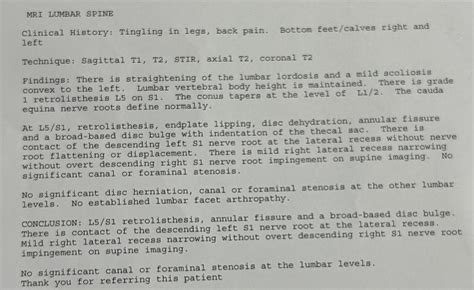 L51 Grade 1 Retrolisthesis Annular Fissure And A Broad Based Disc