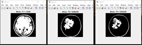 Github Electricianinsomniac Preprocessing Images Preprocessing Images Segmentation With