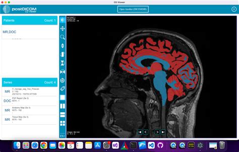 Cd Viewer Usage For Macos Monterey Postdicom Knowledge Base