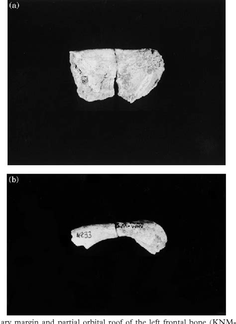 Figure 3 From A New Skeleton Of Theropithecus Brumpti Primates