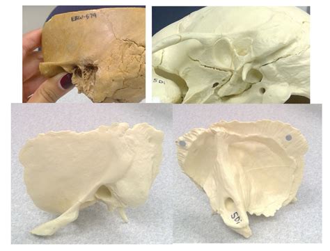 Temporal Diagram Quizlet