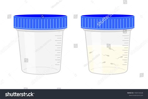 Semen Analysis Sperm Sample Plastic Container Stock Vector Royalty
