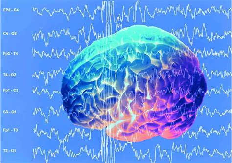 Abai Сайн байцгаана уу Эпилепси буюу унаж татдаг эмгэгийн мэс заслын
