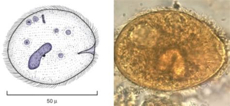 Flagellates Flashcards Quizlet
