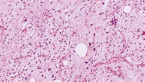 Pathology Outlines Question Bank
