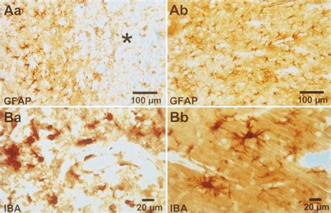 Photomicrographs Aa Cortex At The Site Of The Cranial Window Hours Download Scientific
