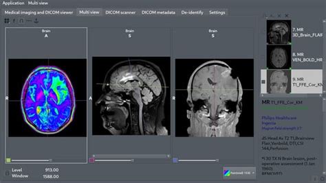 Free Portable DICOM Viewers To Display DICOM Images Directly From CD DVD And USB Drive