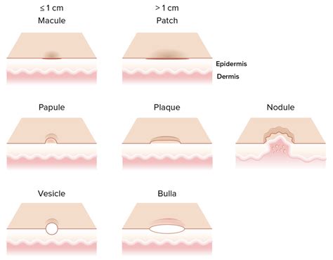 Dermatology Diagram Quizlet