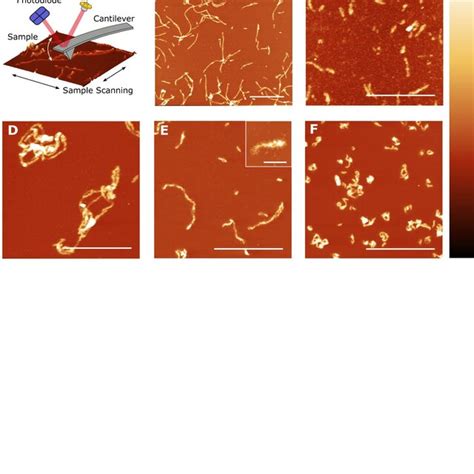 C Kit Mutation At Exon Kit 10 1621a C Met541leu Missense Mutation Download Scientific Diagram