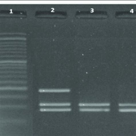 A Results Of Pcr Polymorphism Rs2273505 On Agarose Gel Column 1